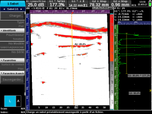 Phased-array ultrasonics : the Aquascan
